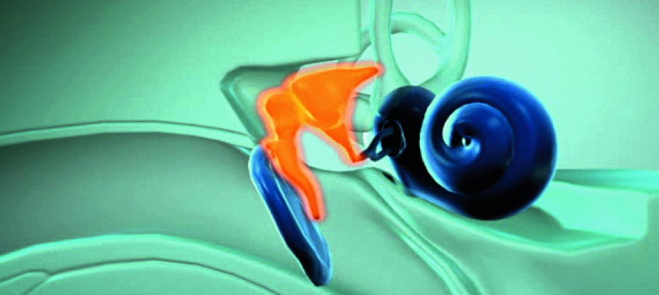 Ons oor - Veranneman